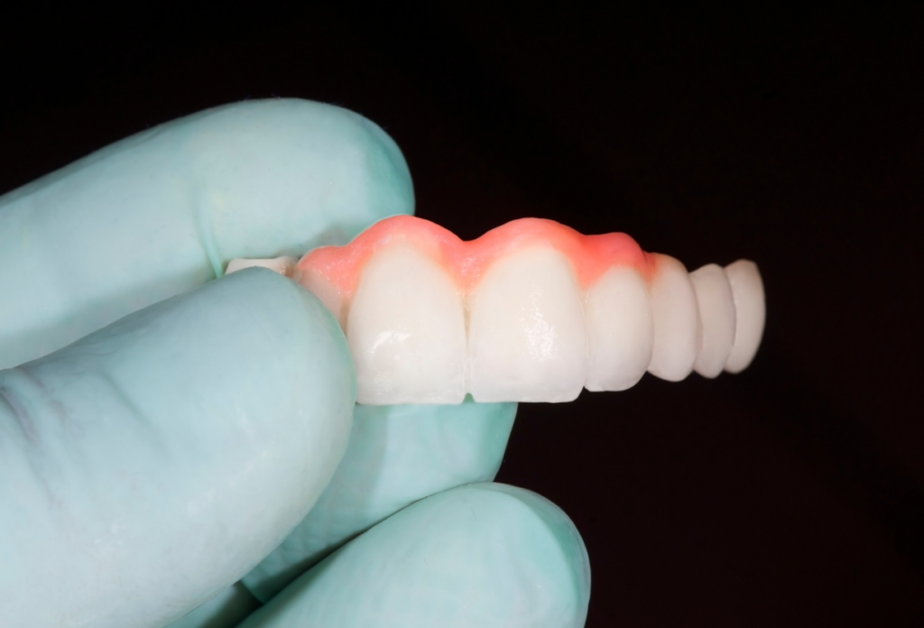 What You Need to Know about Dentures Bridges and Implants - Dr. George ...